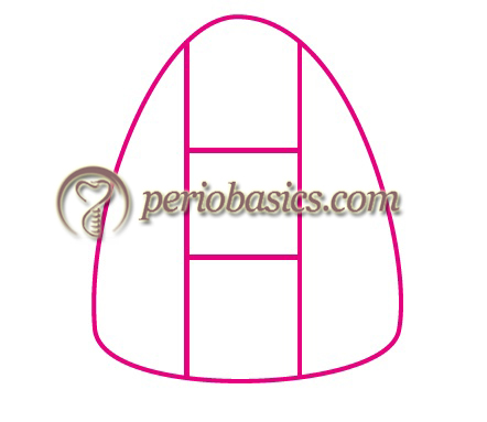Gingival and periodontal indices - periobasics.com Clinical Periodontology