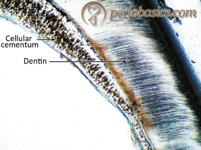 Dental cementum in health and disease, its structure and function.