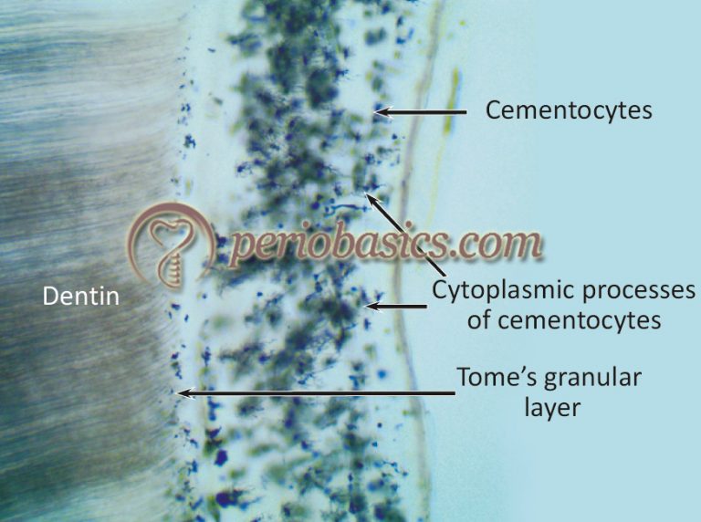 Dental cementum in health and disease, its structure and function.