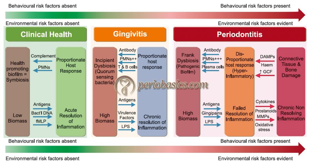 What Is Periodontal Disease Progression at Piper Armit blog