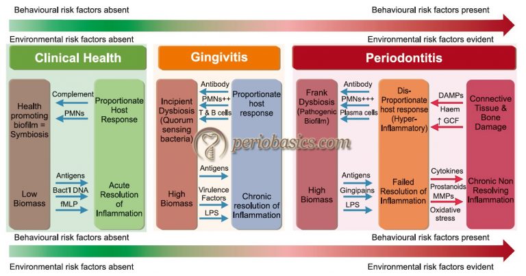 Models of periodontal disease progression - periobasics.com